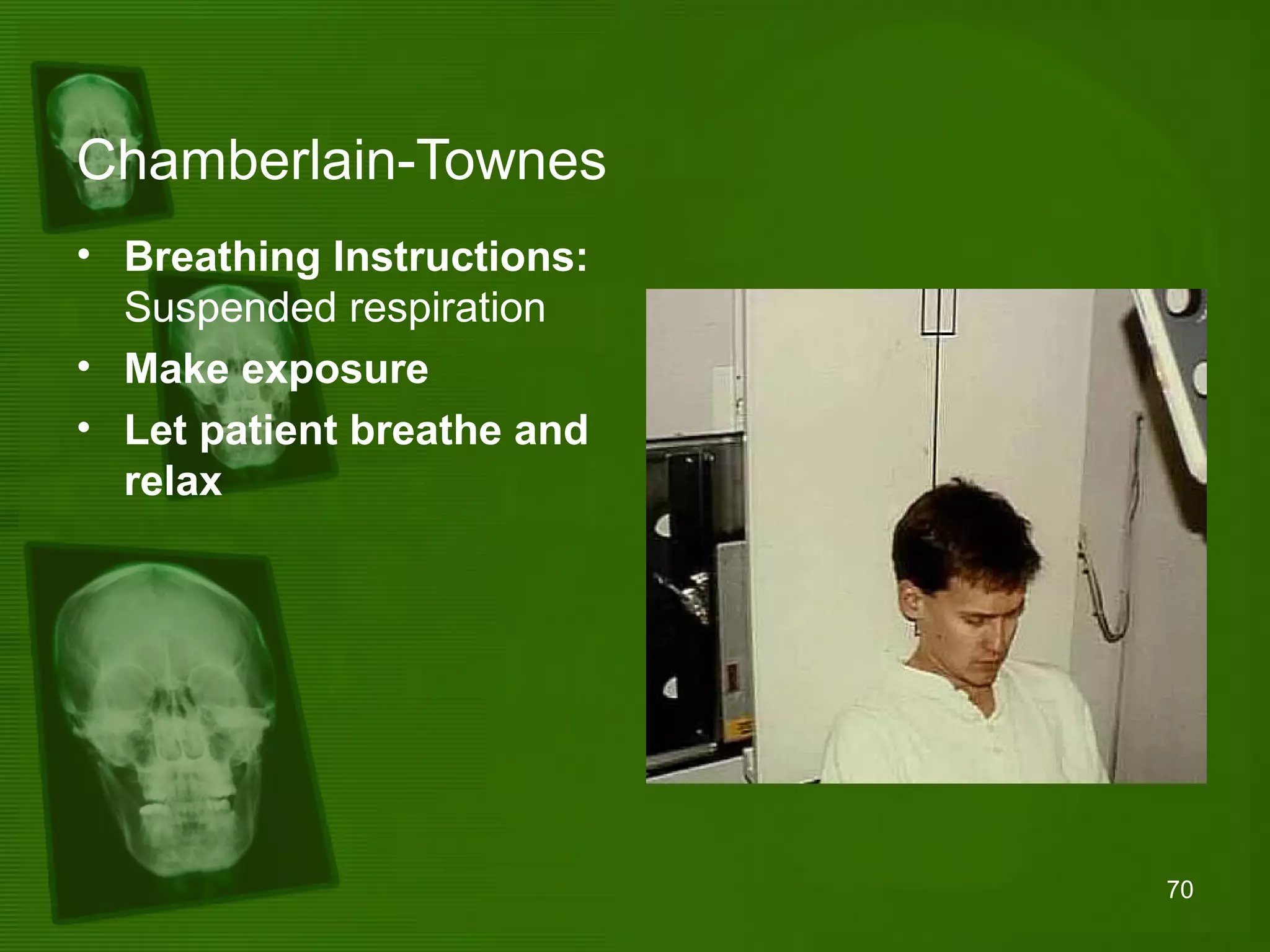 Positioning and radiographic anatomy of the skull | PPT