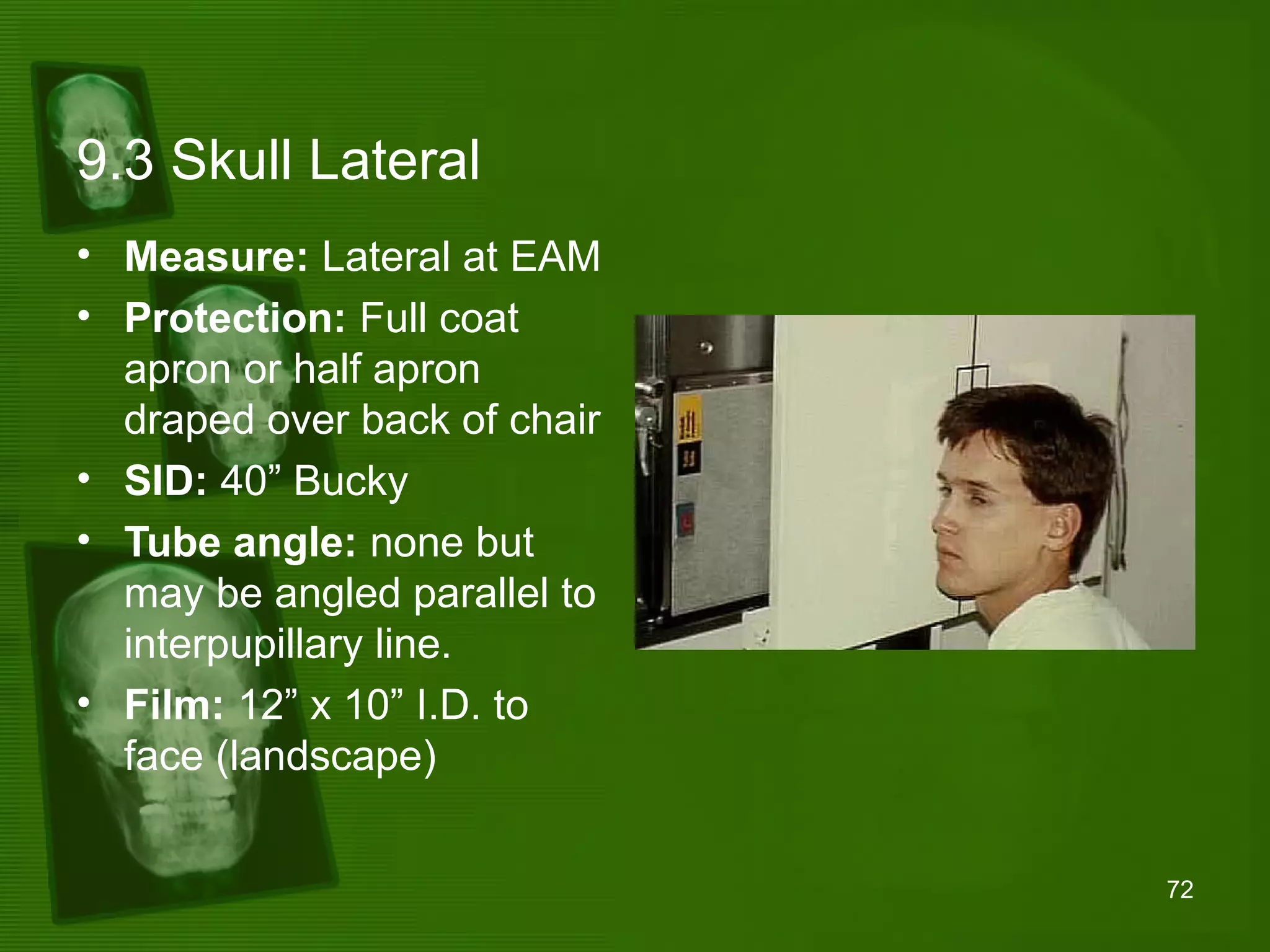 Positioning and radiographic anatomy of the skull | PPT