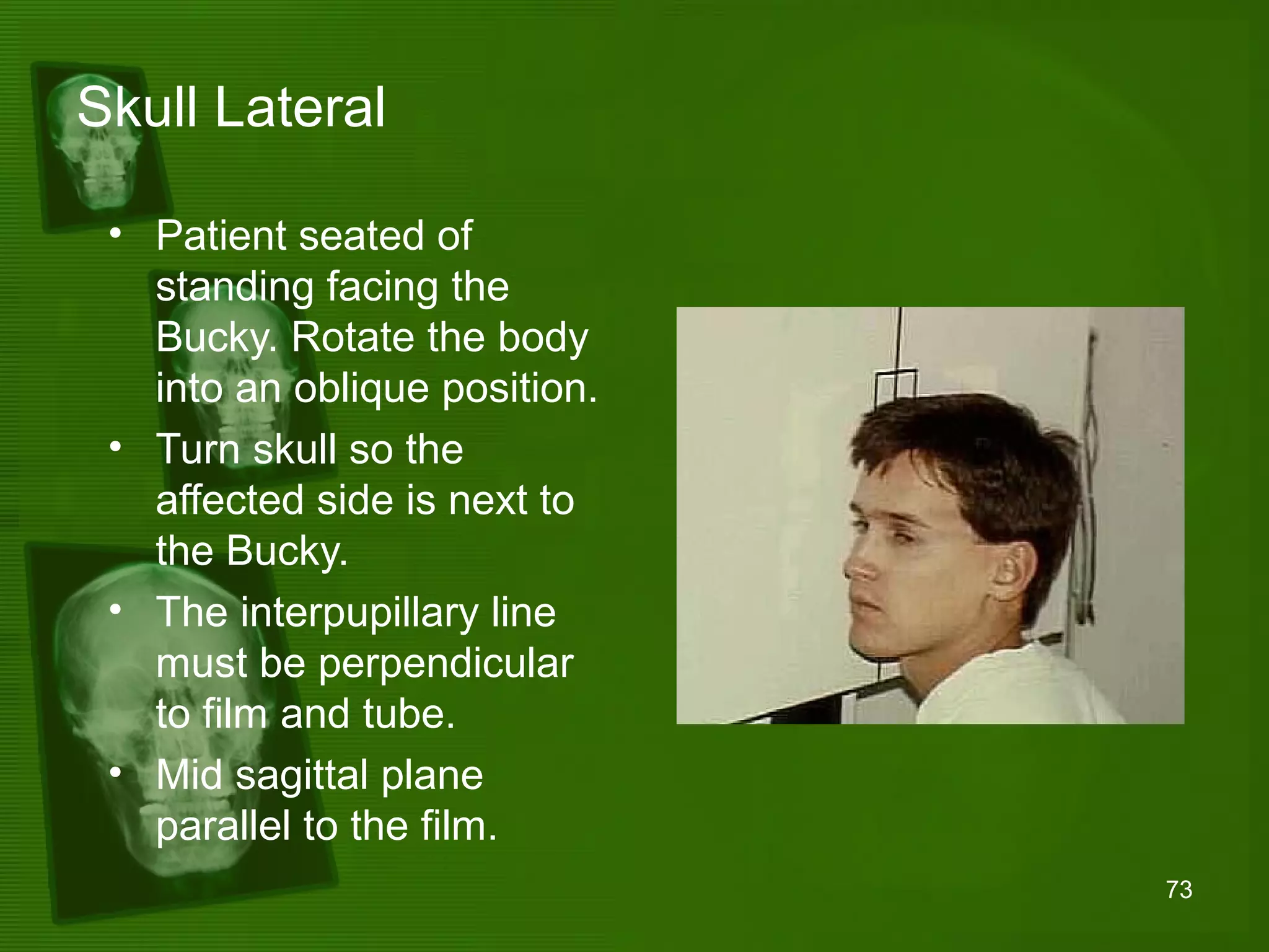 Positioning and radiographic anatomy of the skull | PPT