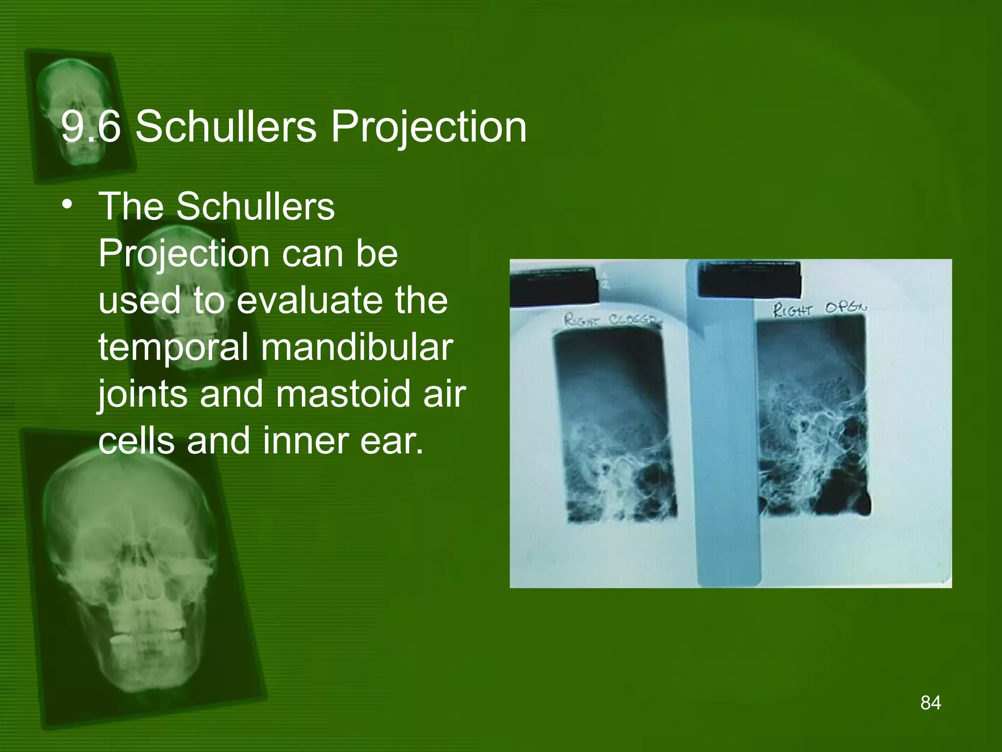 Positioning and radiographic anatomy of the skull | PPT
