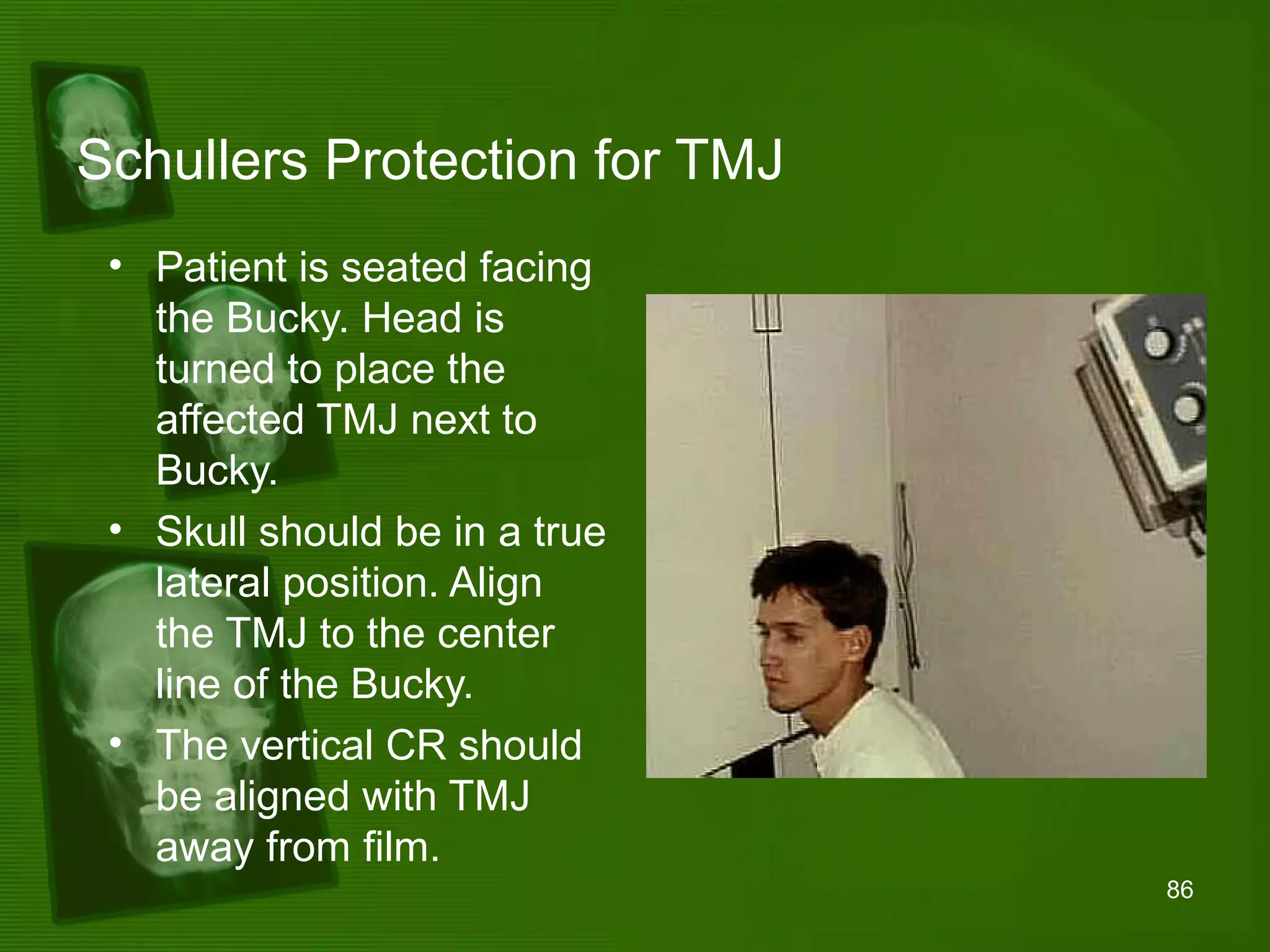 Positioning and radiographic anatomy of the skull | PPT