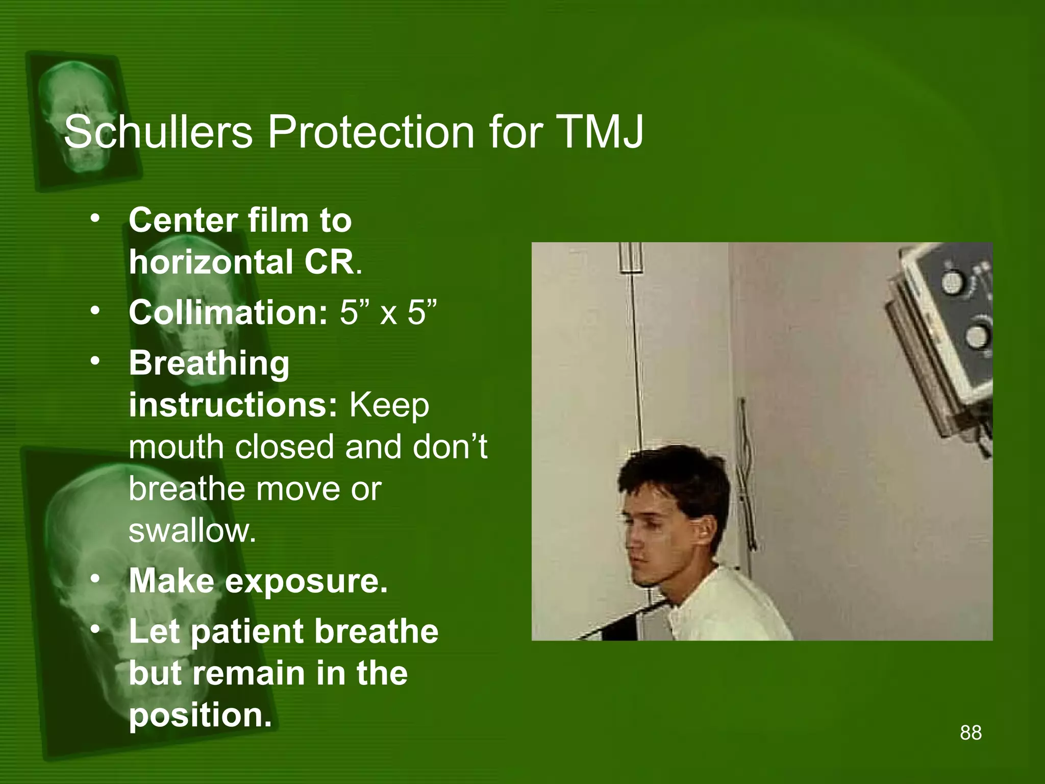 Positioning and radiographic anatomy of the skull | PPT