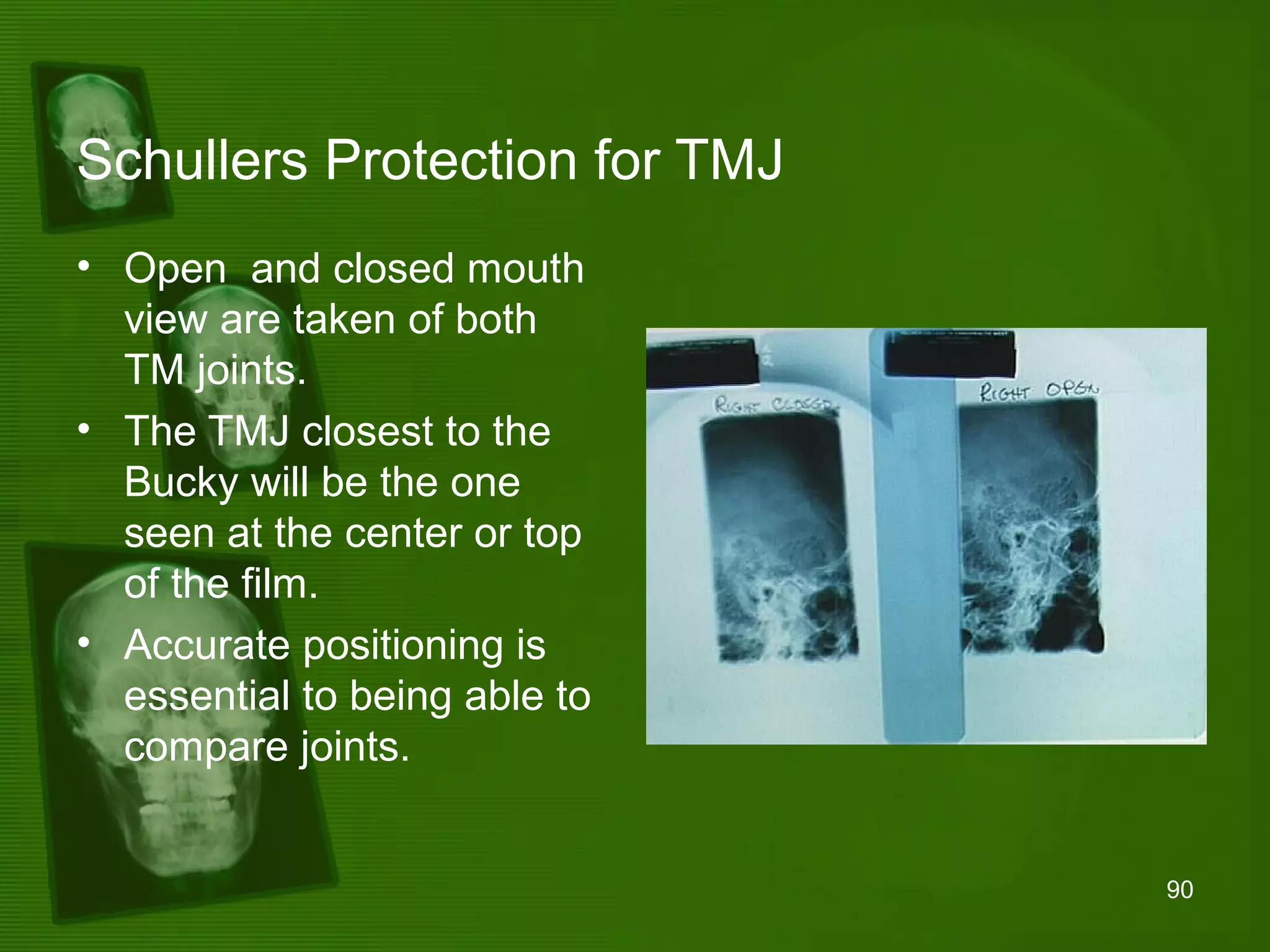 Positioning and radiographic anatomy of the skull | PPT