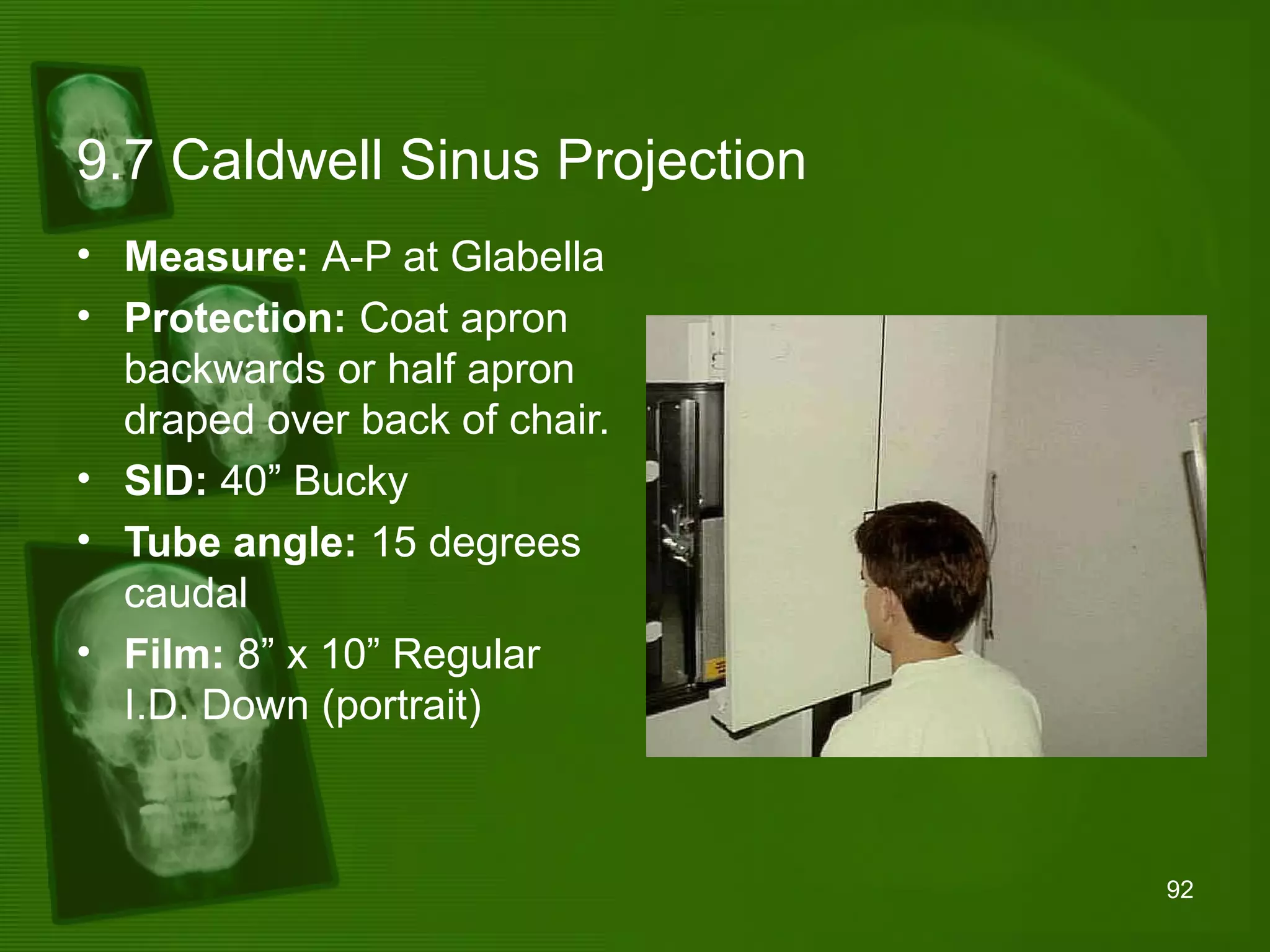 Positioning and radiographic anatomy of the skull | PPT