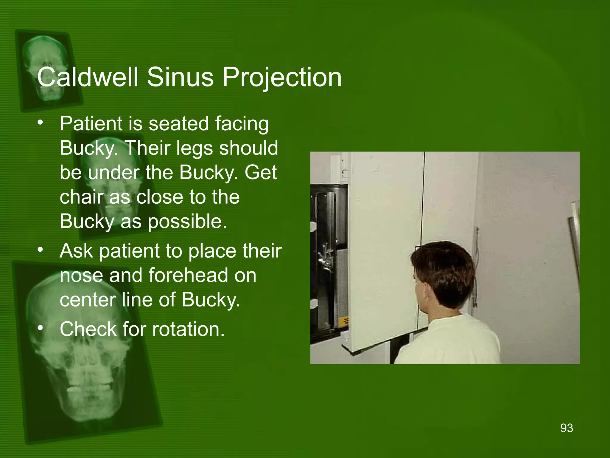 Positioning and radiographic anatomy of the skull | PPT