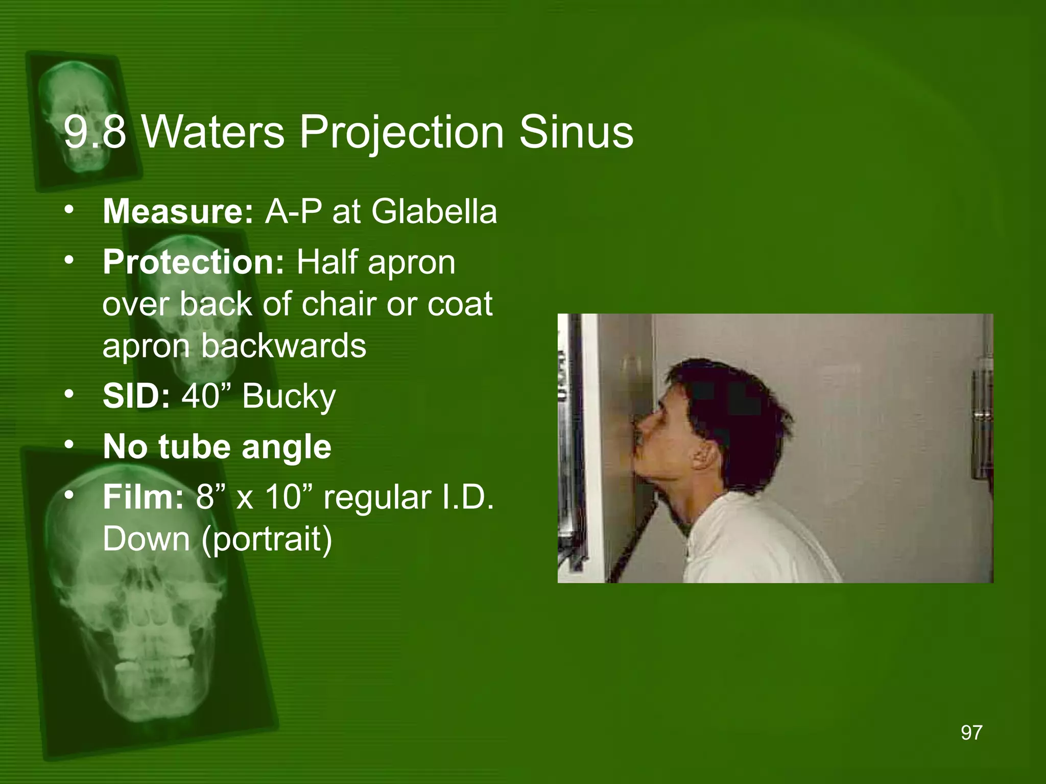 Positioning and radiographic anatomy of the skull | PPT