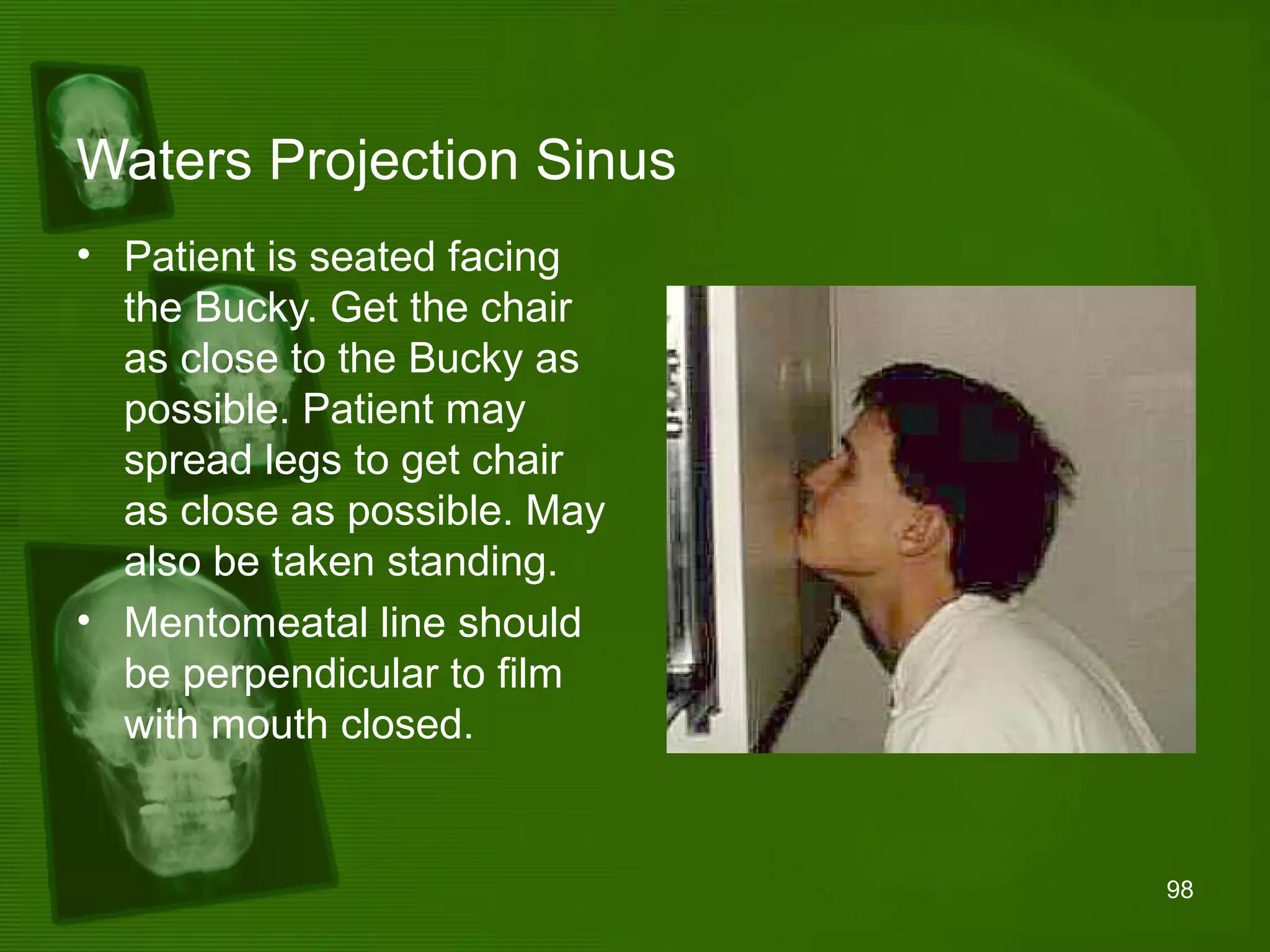 Positioning and radiographic anatomy of the skull | PPT