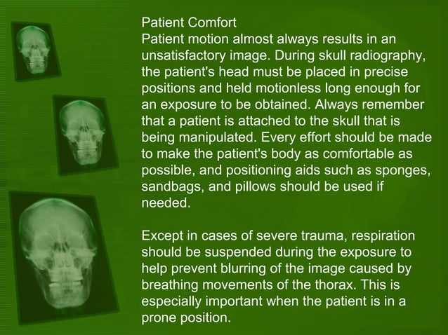 Positioning and radiographic anatomy of the skull | PPT | Bone and ...