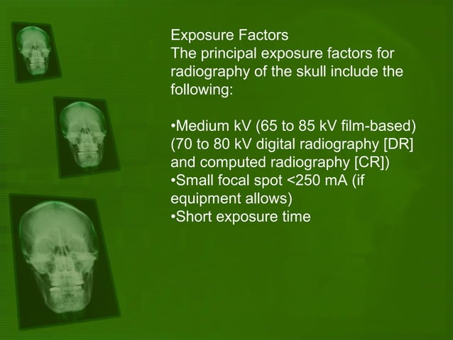 Positioning and radiographic anatomy of the skull | PPT | Bone and ...