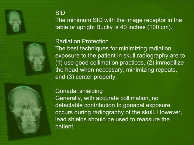 Positioning and radiographic anatomy of the skull | PPT | Bone and ...
