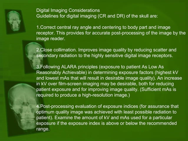 Positioning and radiographic anatomy of the skull | PPT | Bone and ...