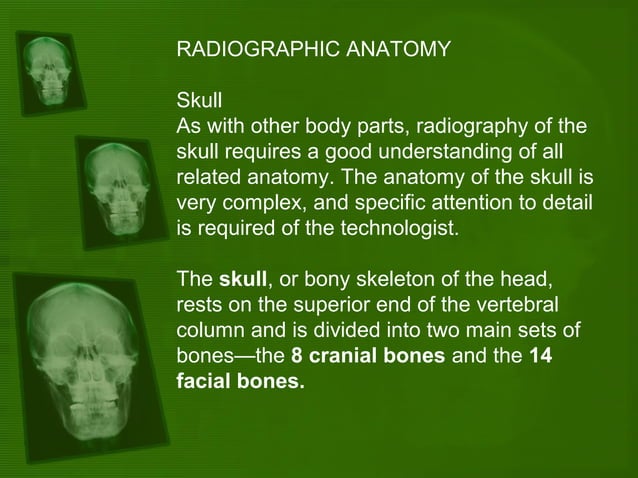 Positioning and radiographic anatomy of the skull | PPT | Bone and ...
