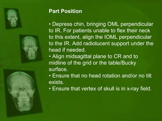 Positioning and radiographic anatomy of the skull | PPT