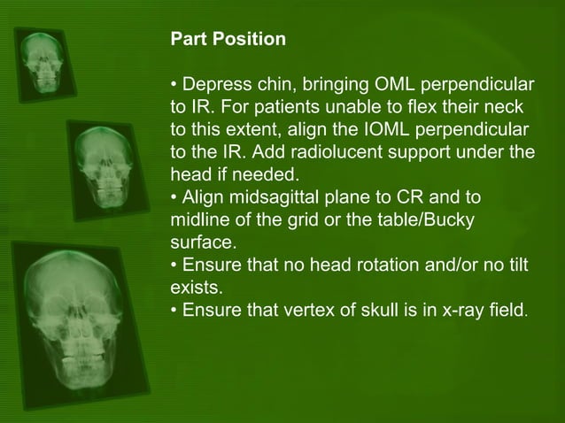 Positioning and radiographic anatomy of the skull | PPT | Bone and ...
