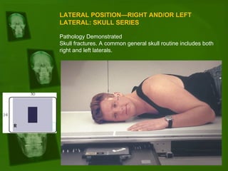 Positioning and radiographic anatomy of the skull | PPT