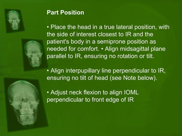 Positioning and radiographic anatomy of the skull | PPT | Bone and ...