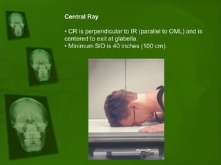 Positioning and radiographic anatomy of the skull | PPT