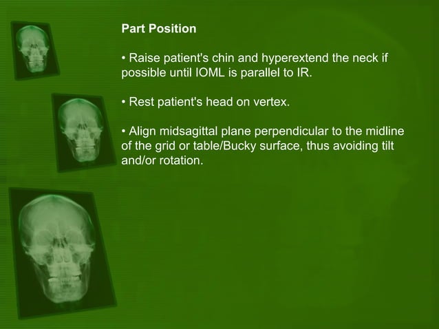 Positioning and radiographic anatomy of the skull | PPT | Bone and ...