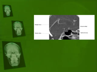 Positioning and radiographic anatomy of the skull | PPT