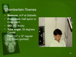 Positioning and radiographic anatomy of the skull | PPT