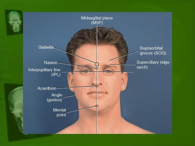 Positioning and radiographic anatomy of the skull | PPT | Bone and ...