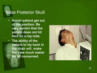 Positioning and radiographic anatomy of the skull | PPT