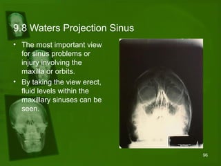 Positioning and radiographic anatomy of the skull | PPT