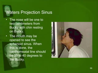 Positioning and radiographic anatomy of the skull | PPT
