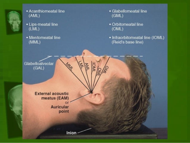 Positioning and radiographic anatomy of the skull