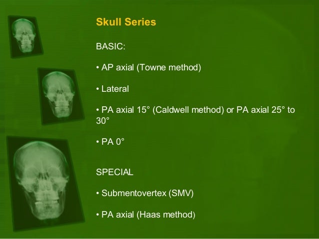 Positioning and radiographic anatomy of the skull