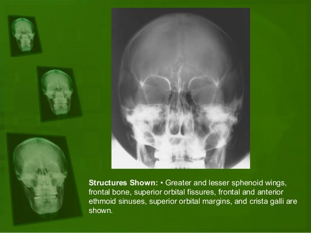 Positioning and radiographic anatomy of the skull