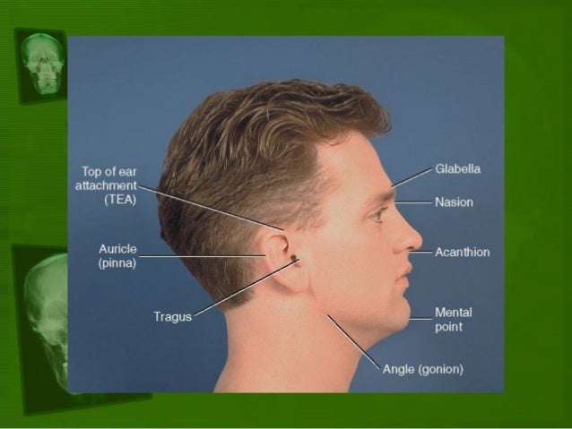 Positioning and radiographic anatomy of the skull
