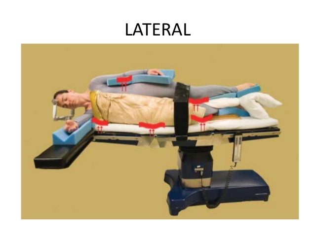 Positioning for supratentoria surgery