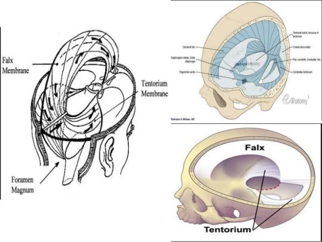 Positioning for supratentoria surgery