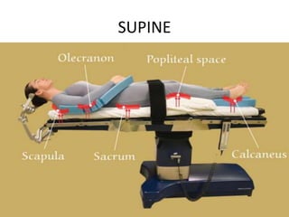 Positioning for supratentorial surgery | PPTX