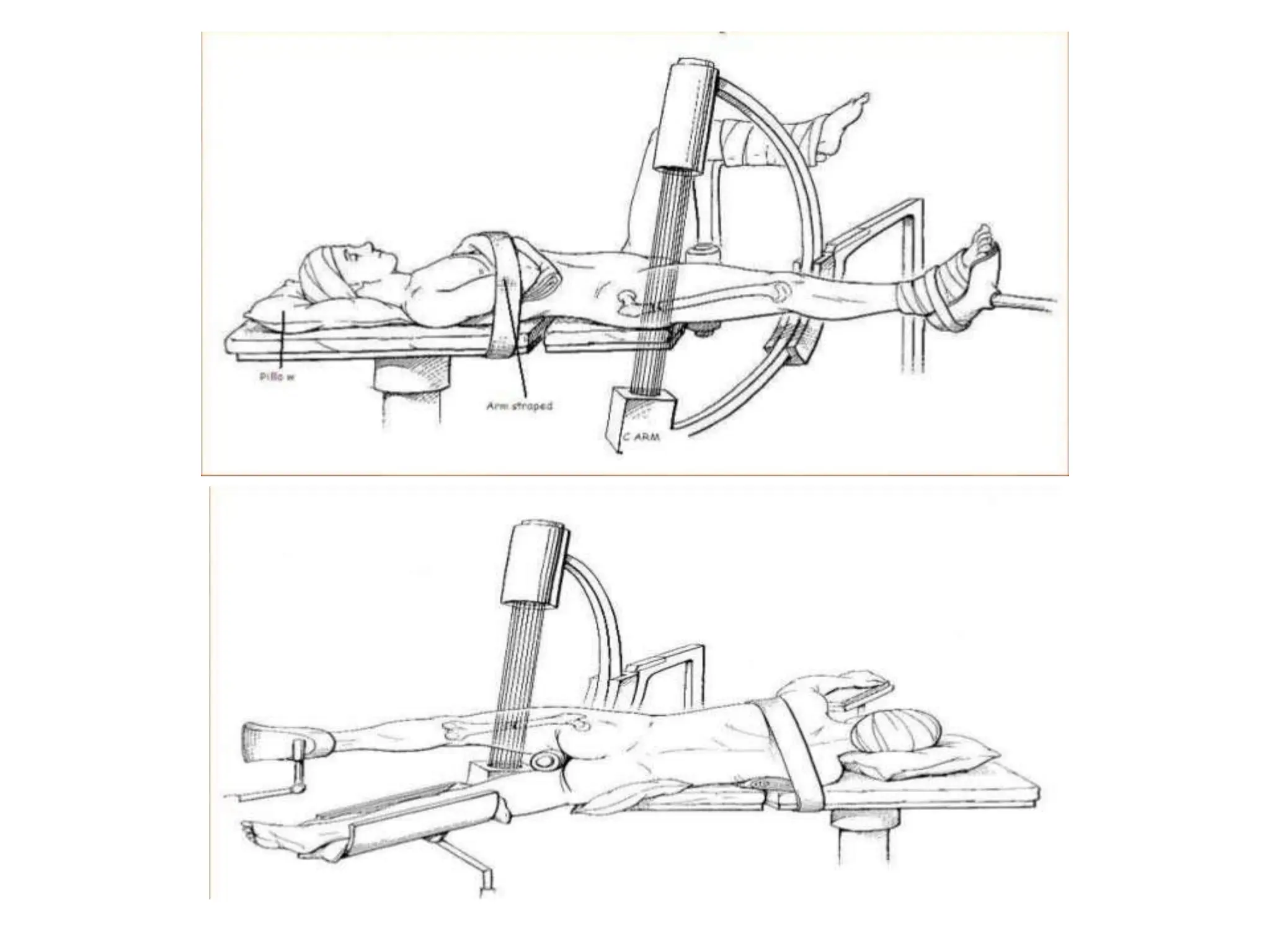 PATIENT POSITIONING AND ANAESTHESIA ppt | PPTX
