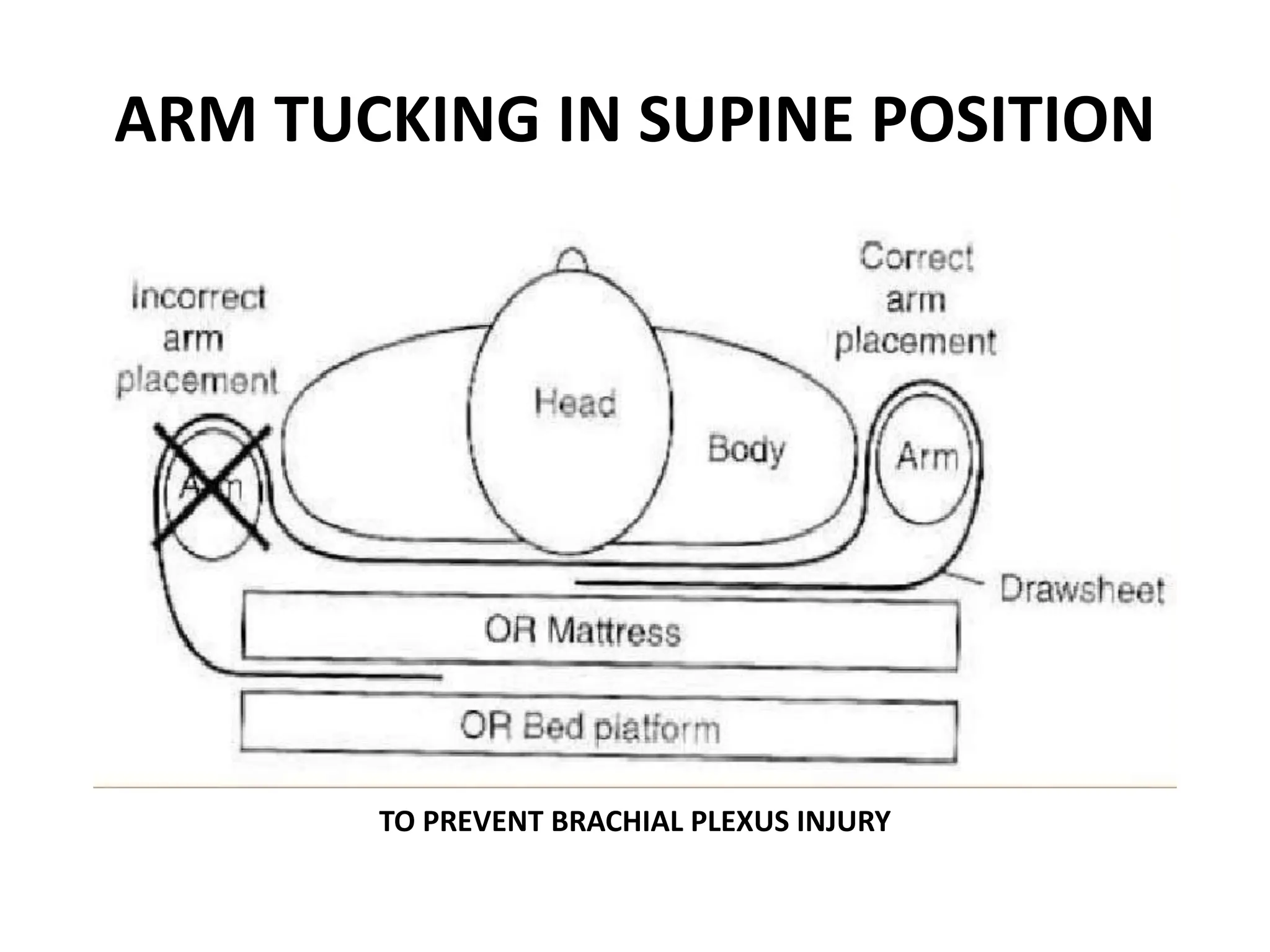 PATIENT POSITIONING AND ANAESTHESIA ppt | PPTX