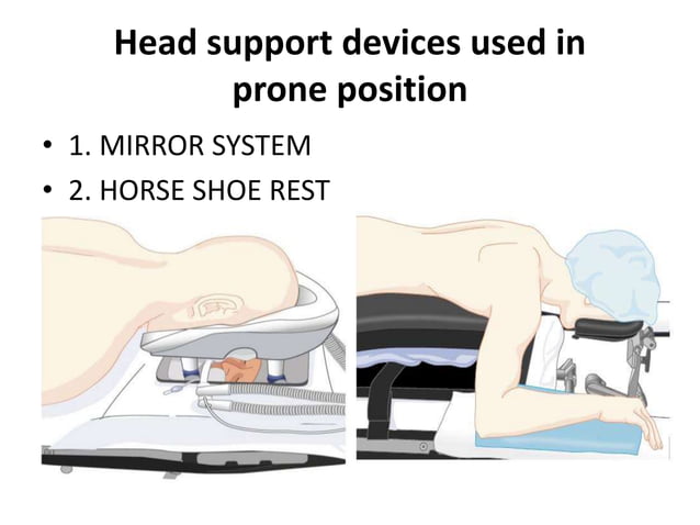 PATIENT POSITIONING AND ANAESTHESIA ppt | PPT