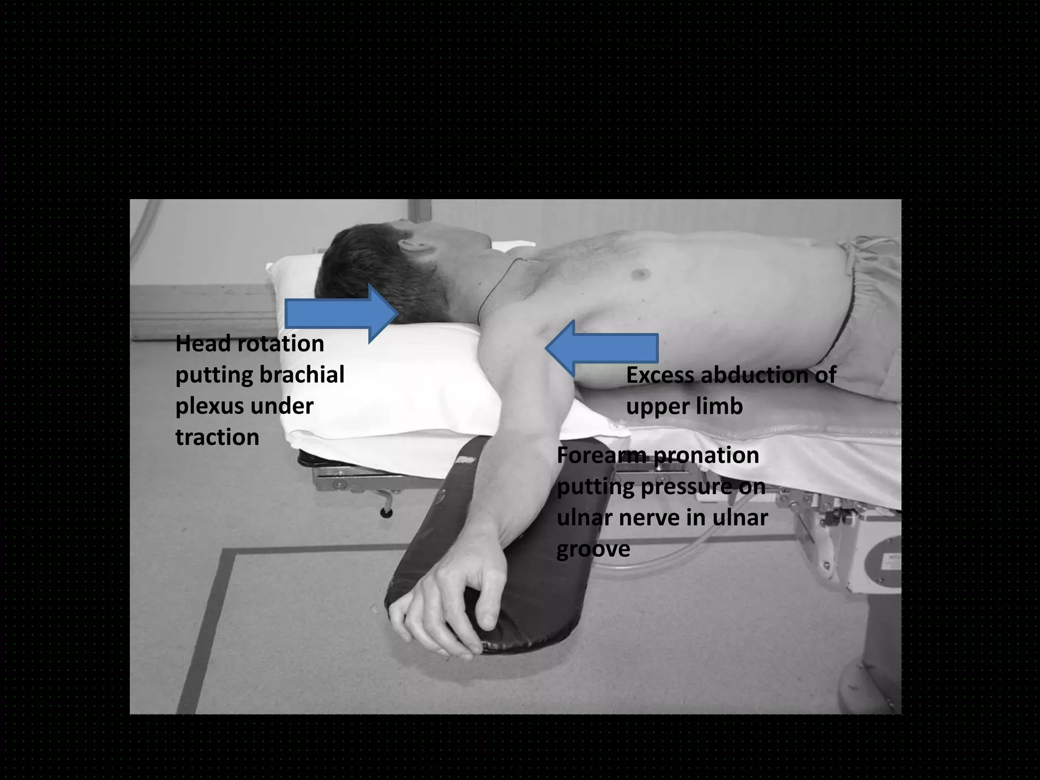 Positioning in anaesthesia mgmc | PPTX