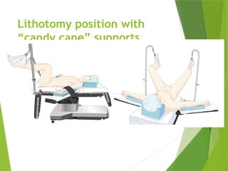 Positioning In Anaesthesia ppt., different types,advantages,side ...