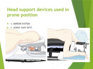 Positioning In Anaesthesia ppt., different types,advantages,side ...
