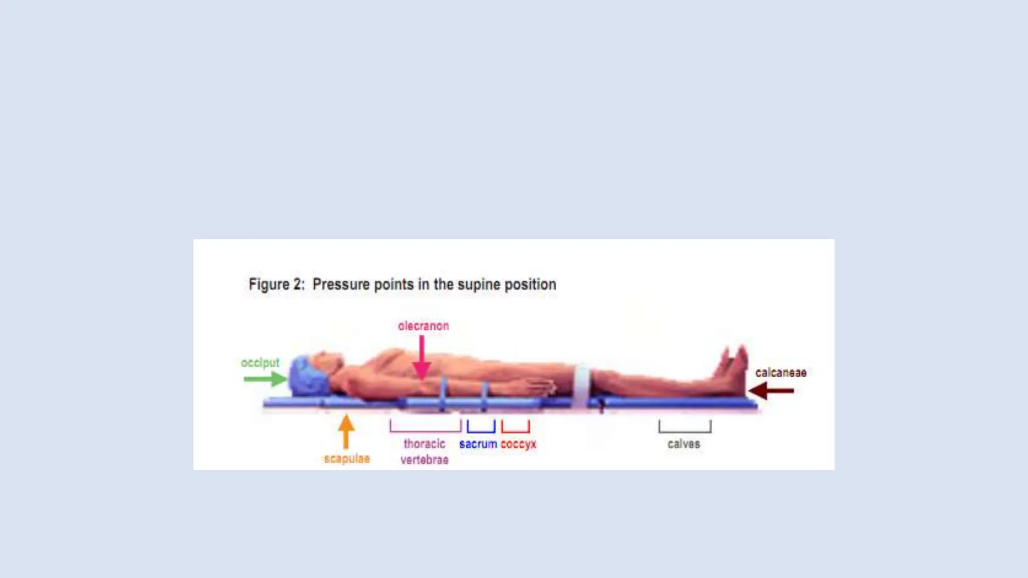 DIFFERENT POSITIONING IN NEUROANAESTHESIA | PPTX