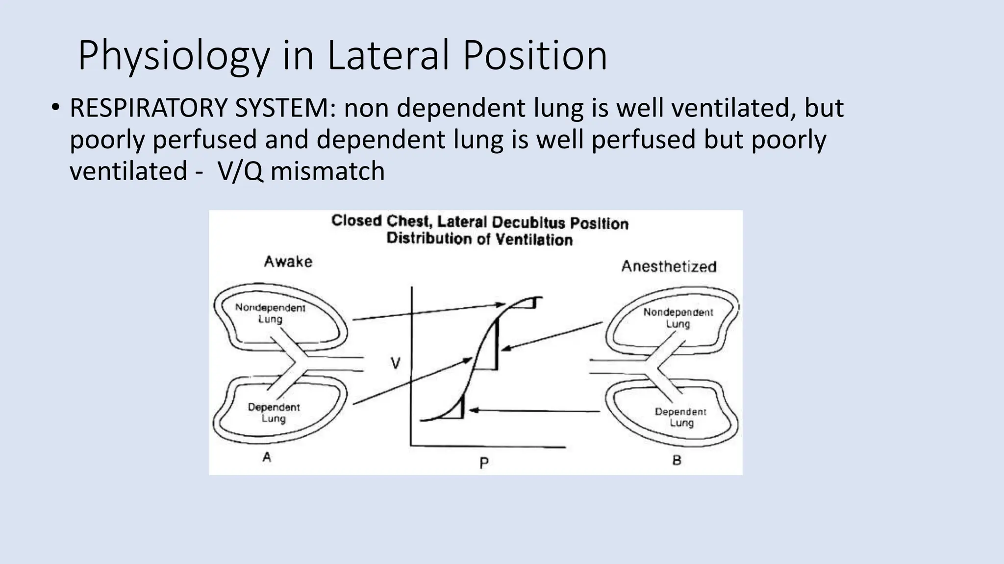 DIFFERENT POSITIONING IN NEUROANAESTHESIA | PPTX