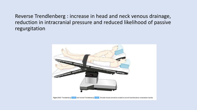 DIFFERENT POSITIONING IN NEUROANAESTHESIA | PPTX | Death, Injury, or ...