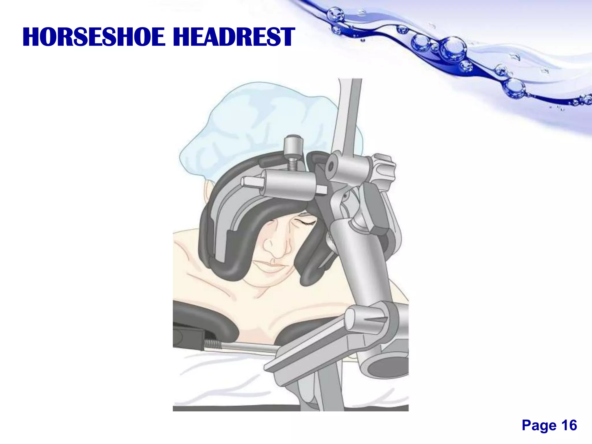 Positioning in neurosurgeries | PPTX