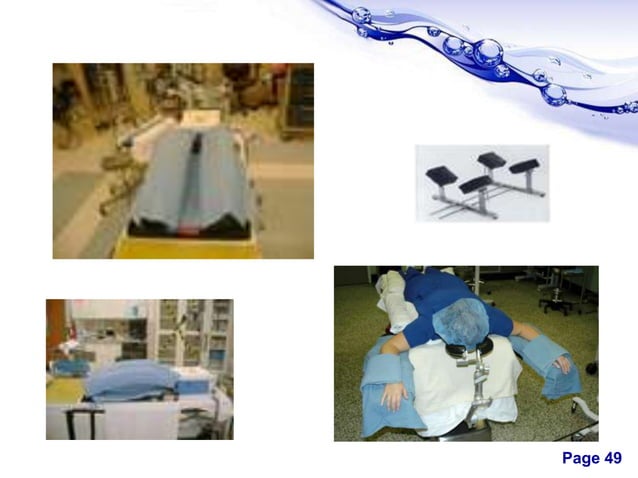 Positioning in neurosurgeries | PPT | Free Download
