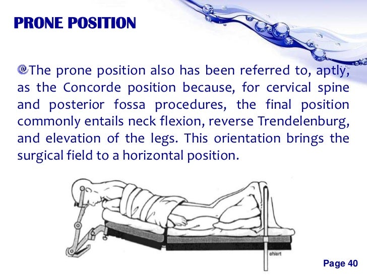 Positioning in neurosurgeries