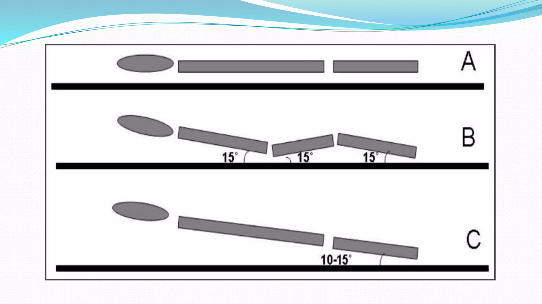 Positioning in neurosurgery | PPTX