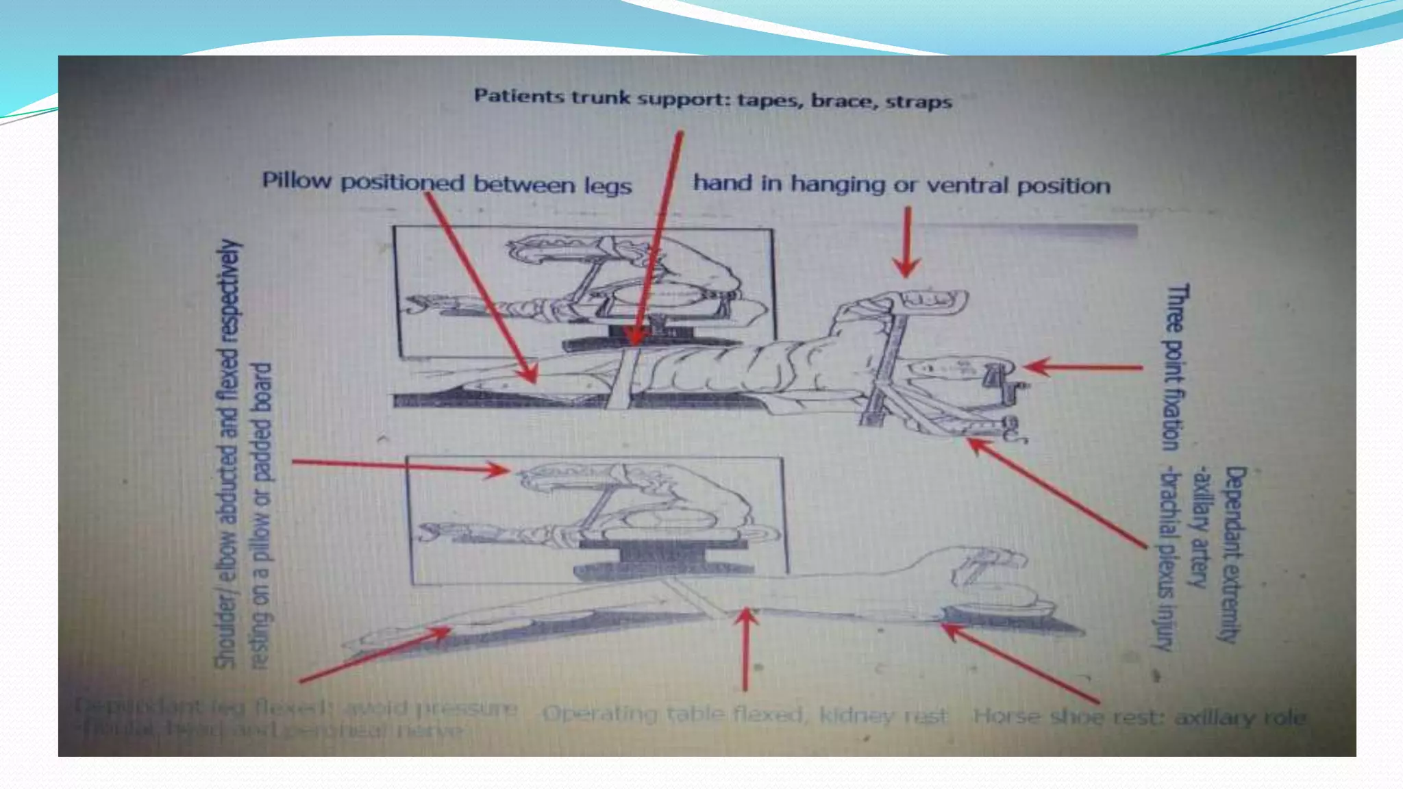 Positioning in neurosurgery | PPTX