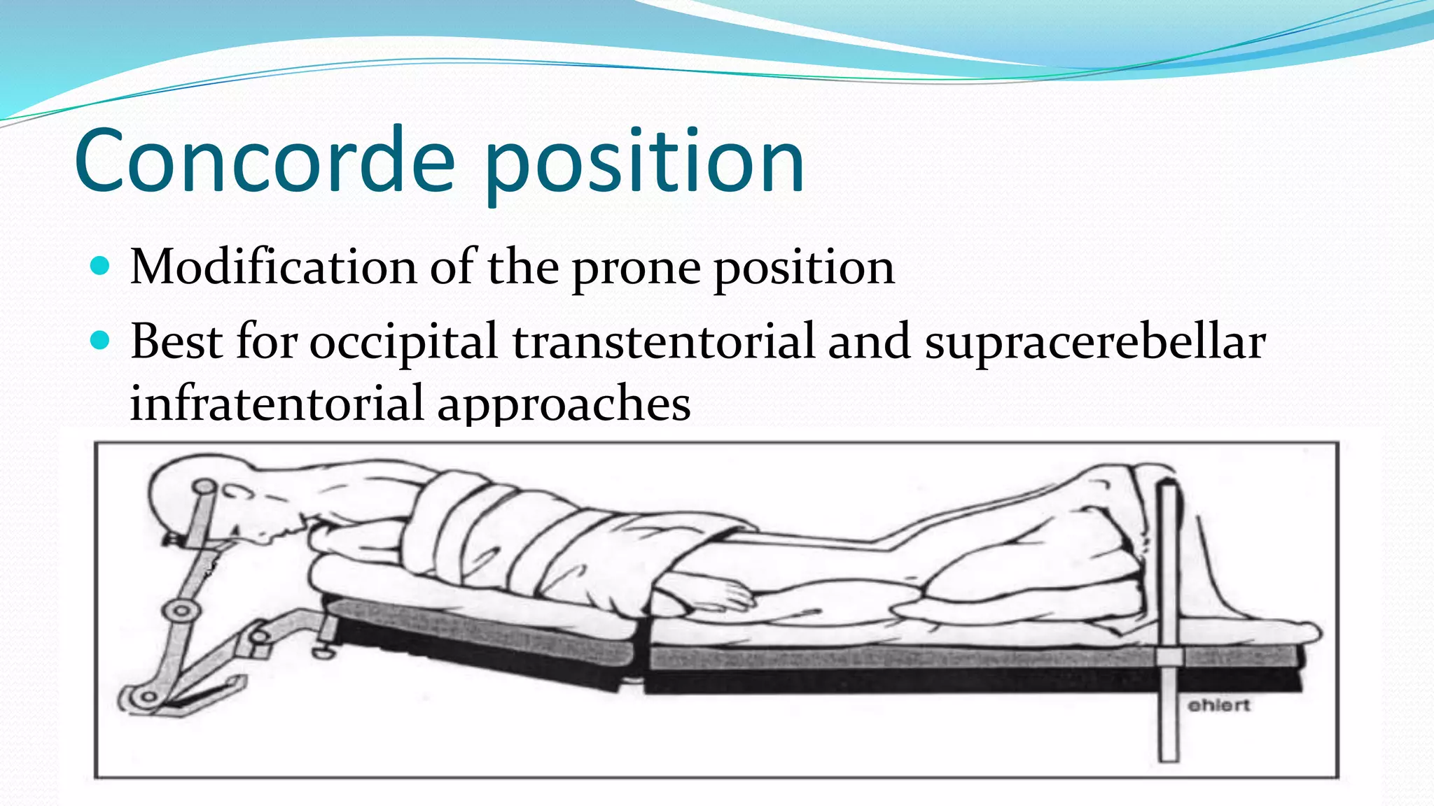 Positioning in neurosurgery | PPTX